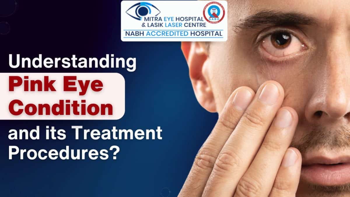 Everything You Should Know About Pink Eye Condition