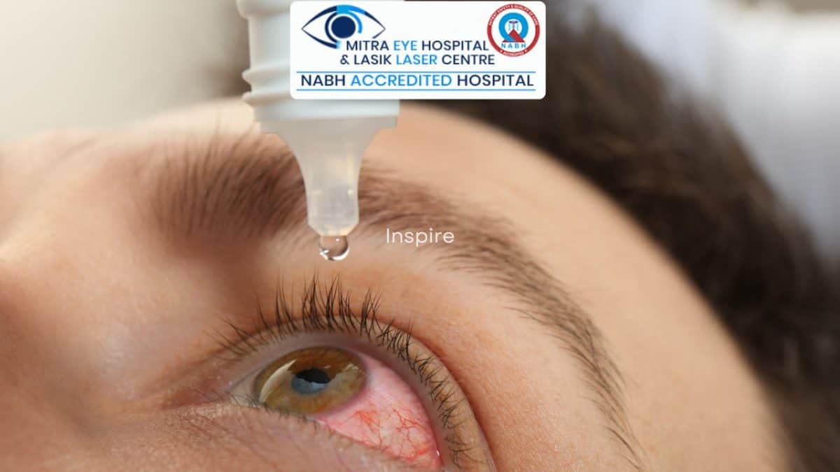 Everything You Should Know About Pink Eye Condition