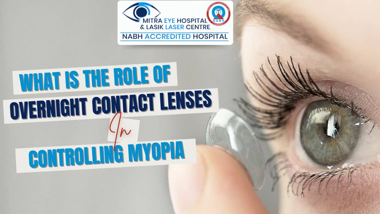 Overnight Contact Lenses: A Solution for Controlling Myopia