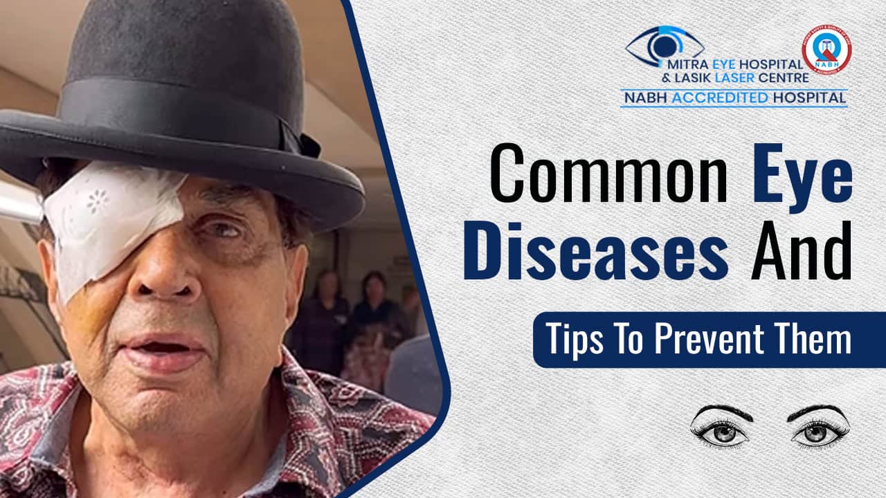 List Of Eye Diseases And How Can Avoid Them.